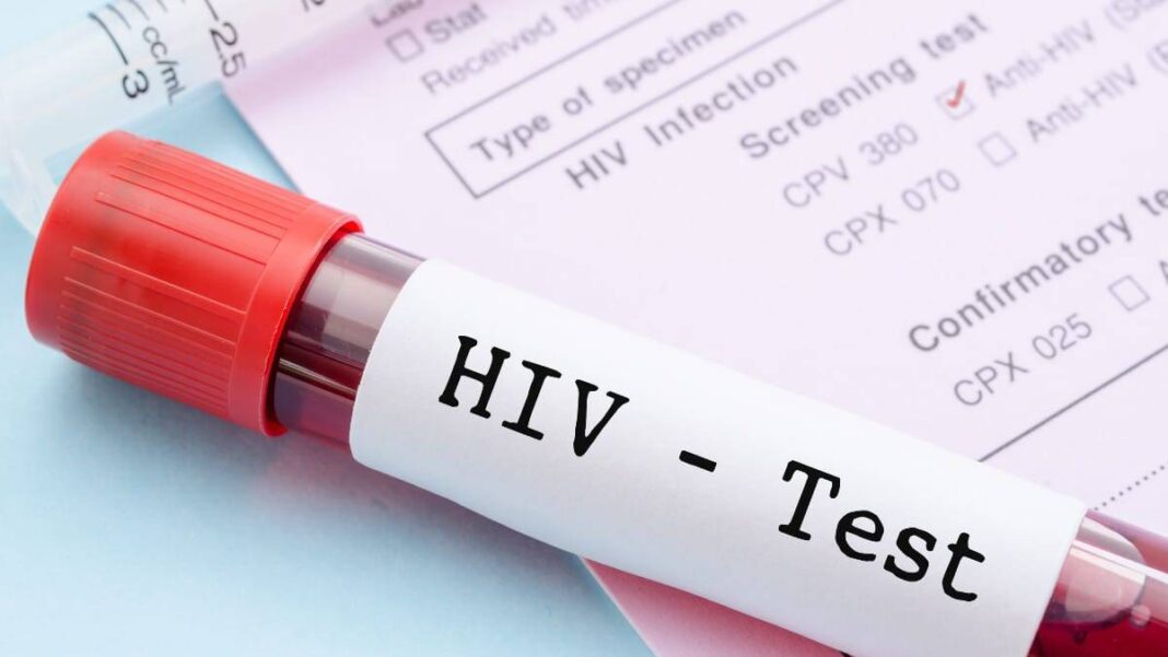Saiba quais os sintomas da fase inicial do HIV